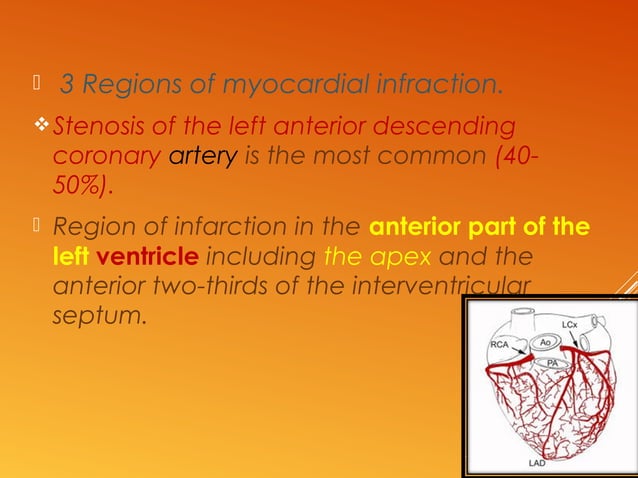 Infarction | PPT | Heart and Cardiovascular Diseases | Diseases and ...