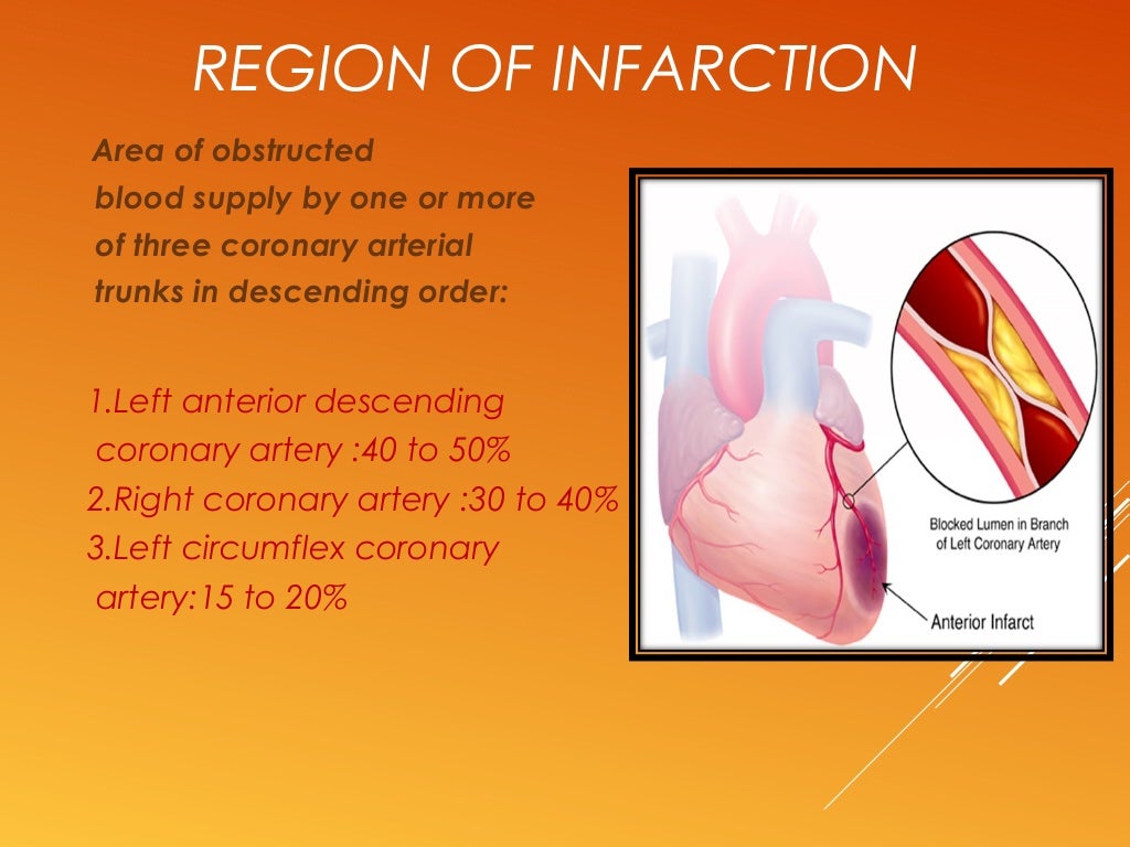 Infarction