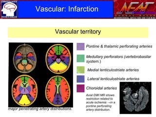 Infarction and some important lesions mimicking brain tumour | PPT