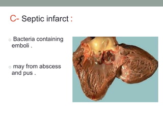 Infarction Path-201.pptx