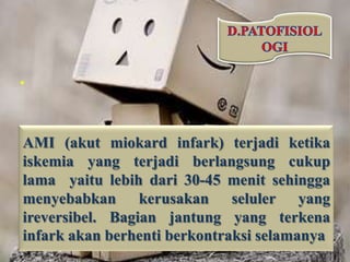 Infark miokard | PPT