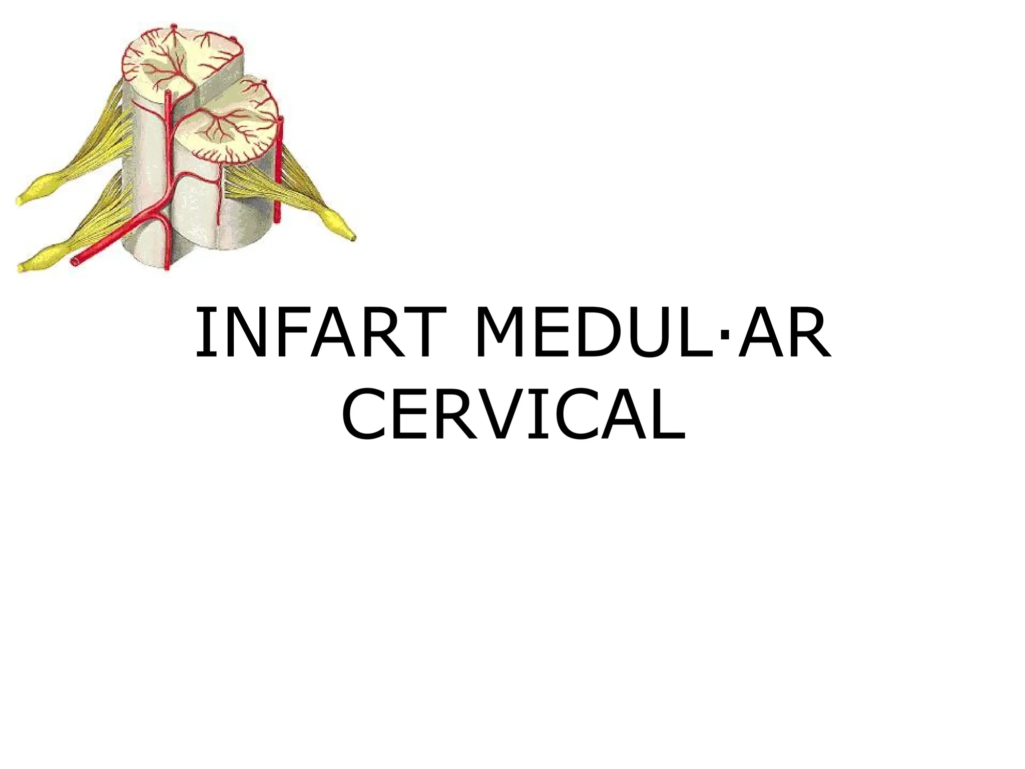 Infart pRESENTACION INFARTO CEREBRAL EN UNIDAD | PPT
