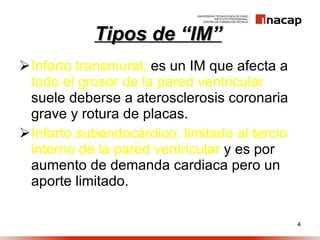 Infarto al miocardio | PPT
