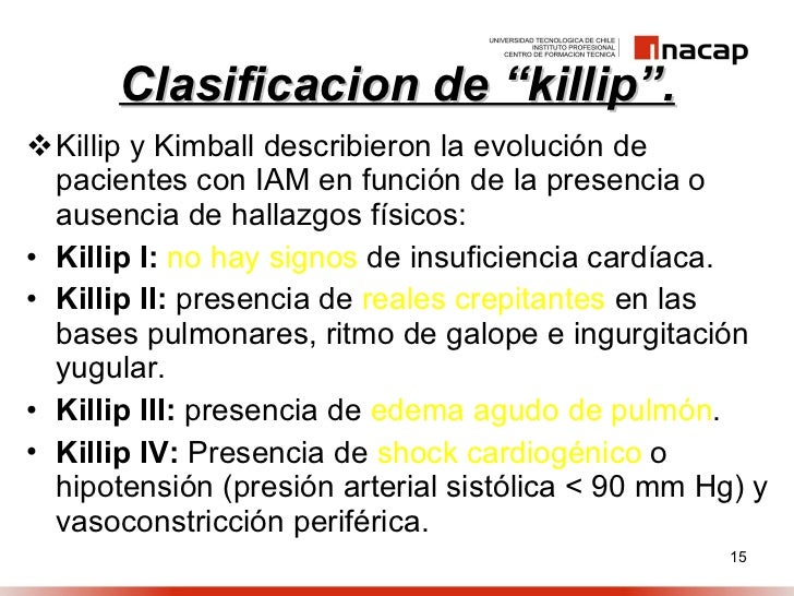 Infarto al miocardio