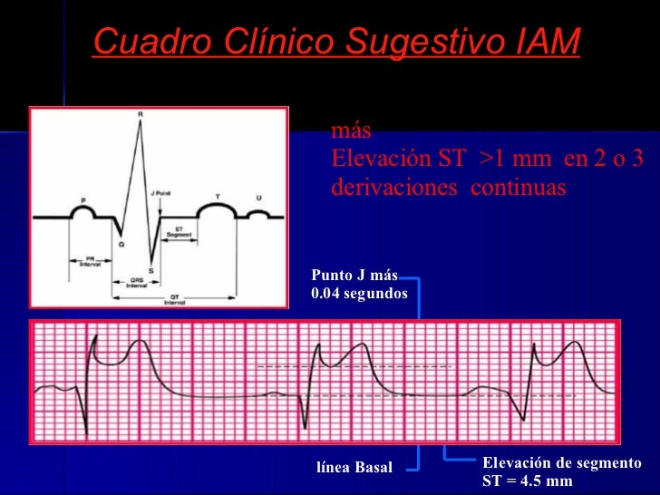 MANEJO EN EL PRIMER NIVEL DEL IAM