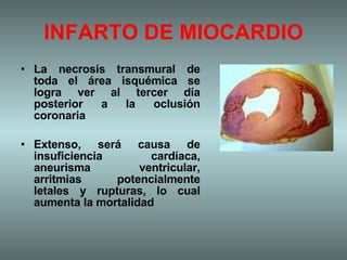 Infarto De Mio Cardio Max | PPT