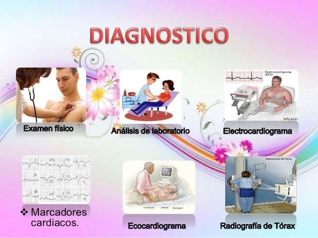 Infarto Agudo y Miocardio