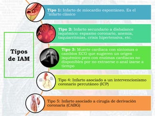 Infarto Agudo de Miocardio | PPTX