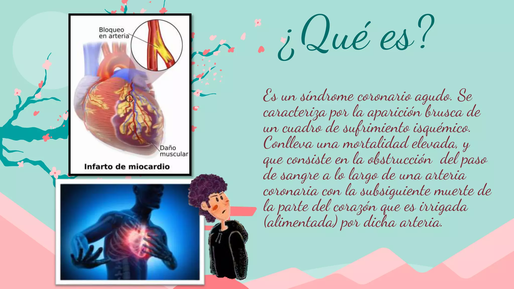 infarto agudo de miocardio.pptx