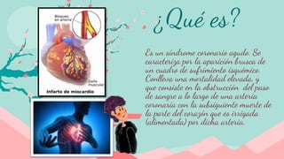 infarto agudo de miocardio.pptx