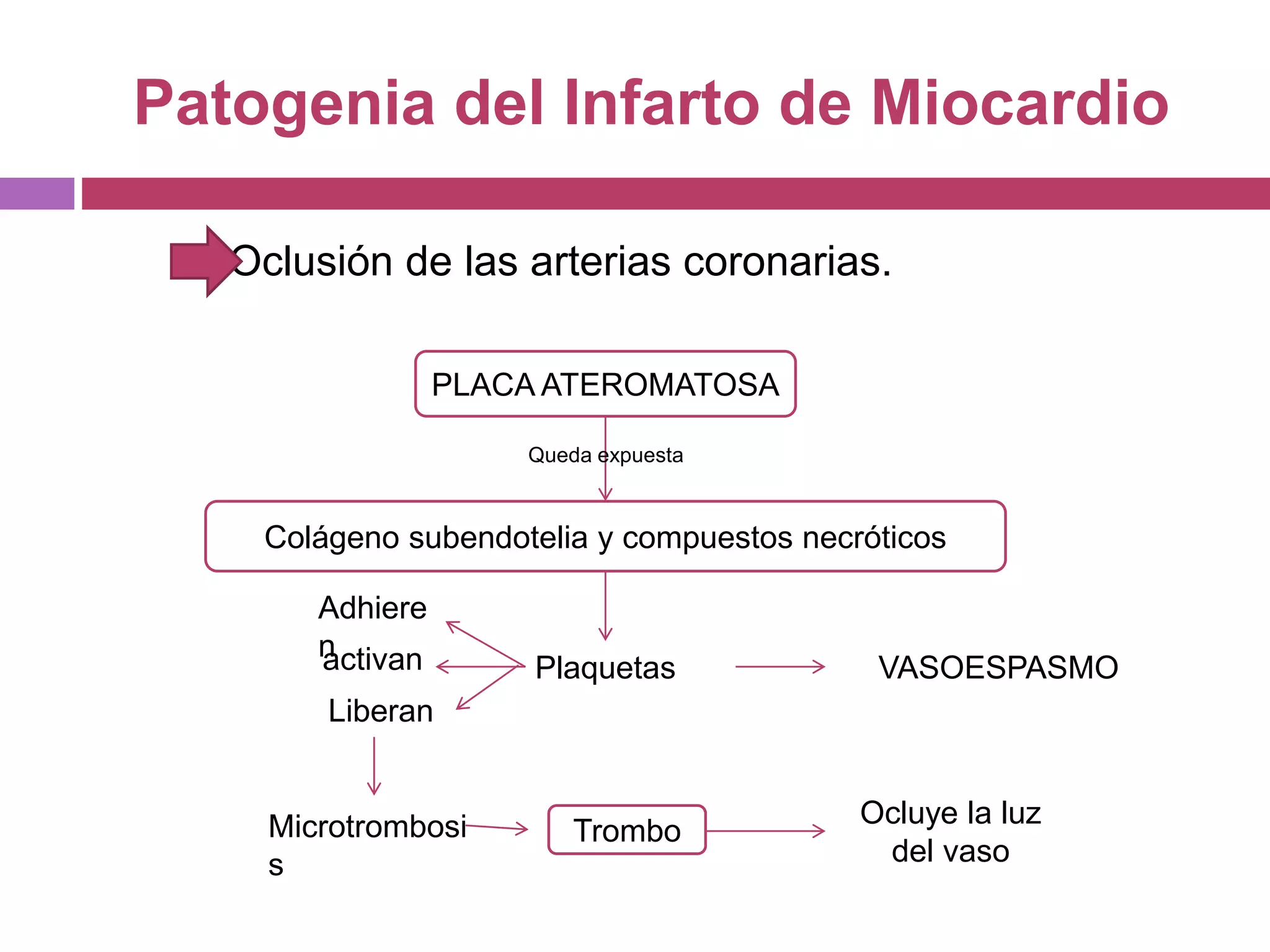 Infarto al miocardio | PPTX