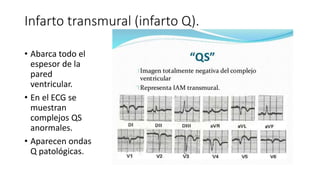 Infarto al miocardio | PPTX