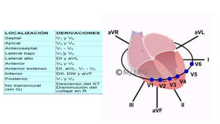 Infarto al miocardio | PPTX