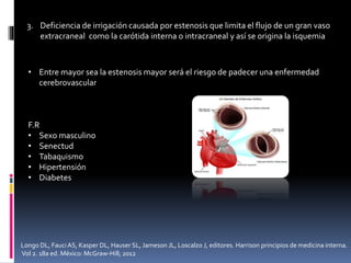 Infarto cerebral | PPTX