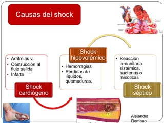 Infarto y shock | PPTX
