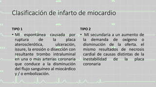 Infarto de miocardio sin elevación del ST.pptx