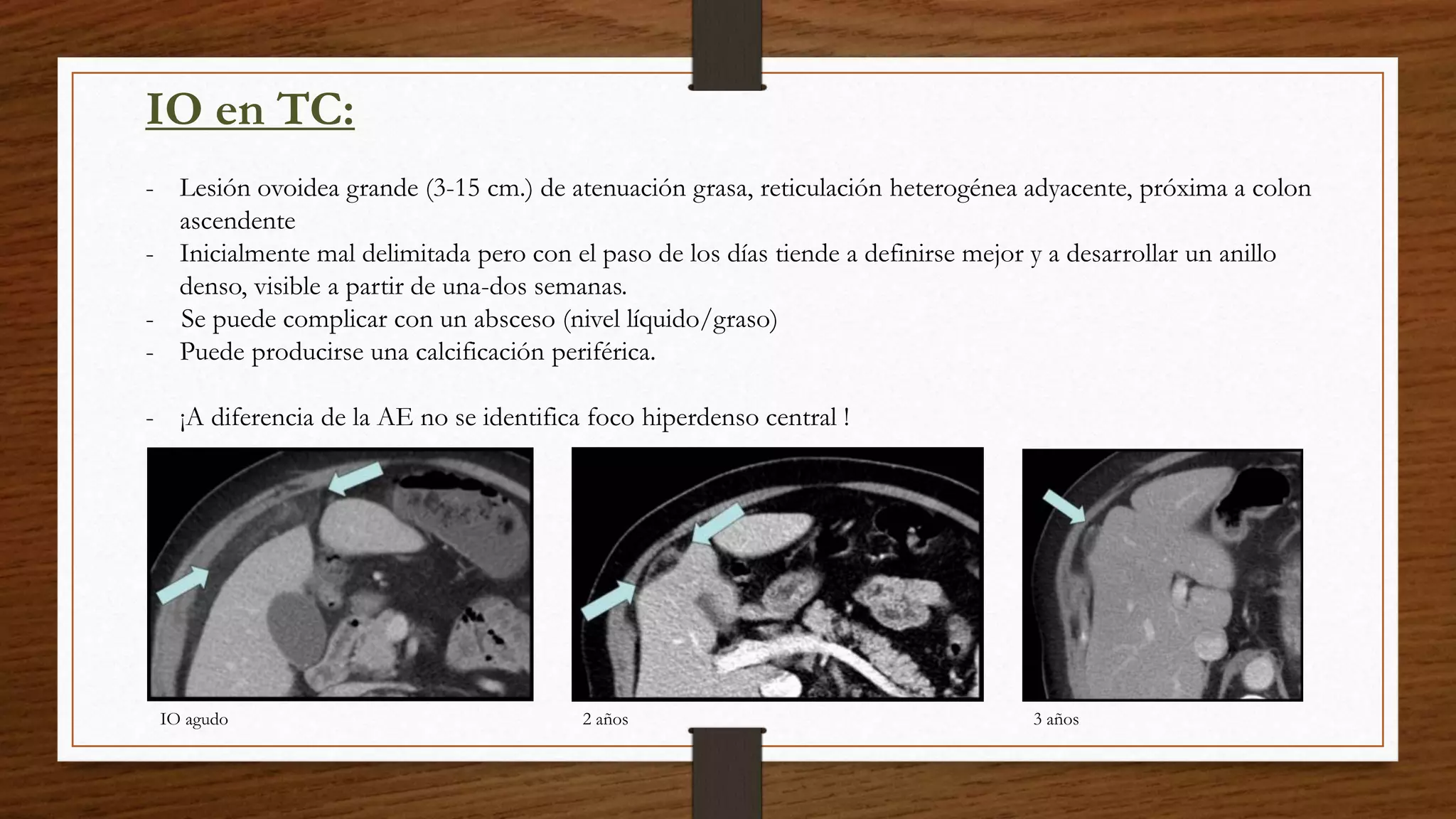 Lectura de caso. infarto omental | PPTX