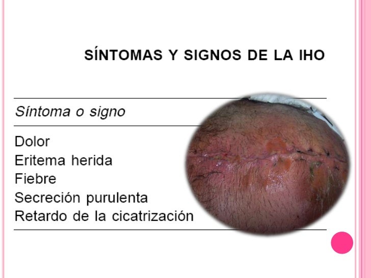 Infección herida quirúrgica