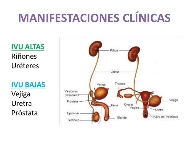 Infección de vias urinarias