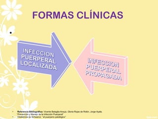 INFECCIÓN PUERPERAL | PPT