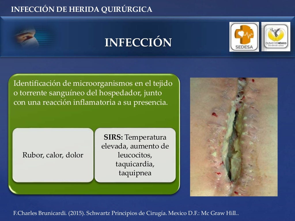 Infeccion de herida quirurgica