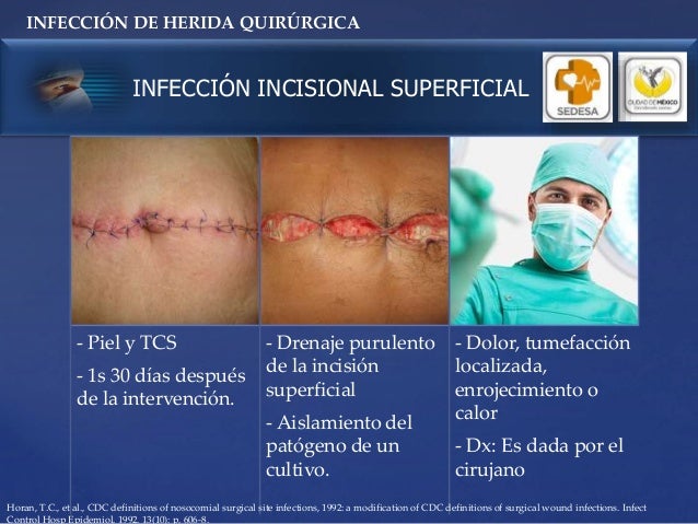 Infeccion de herida quirurgica