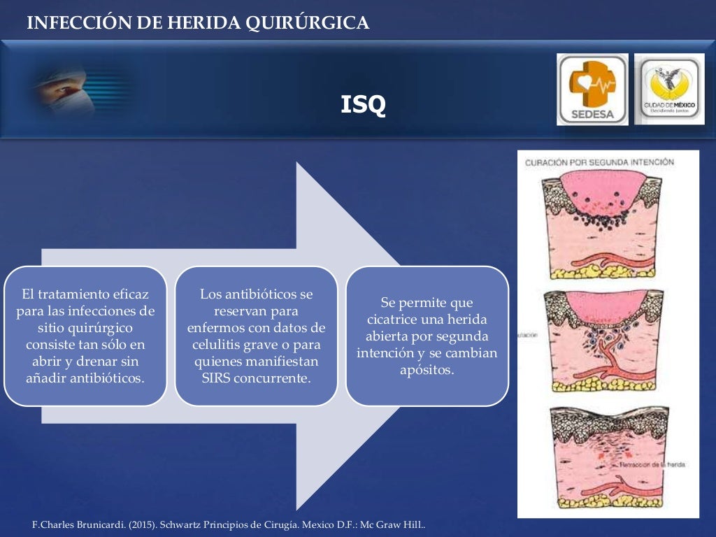Infeccion de herida quirurgica