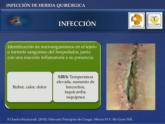 Infeccion de herida quirurgica