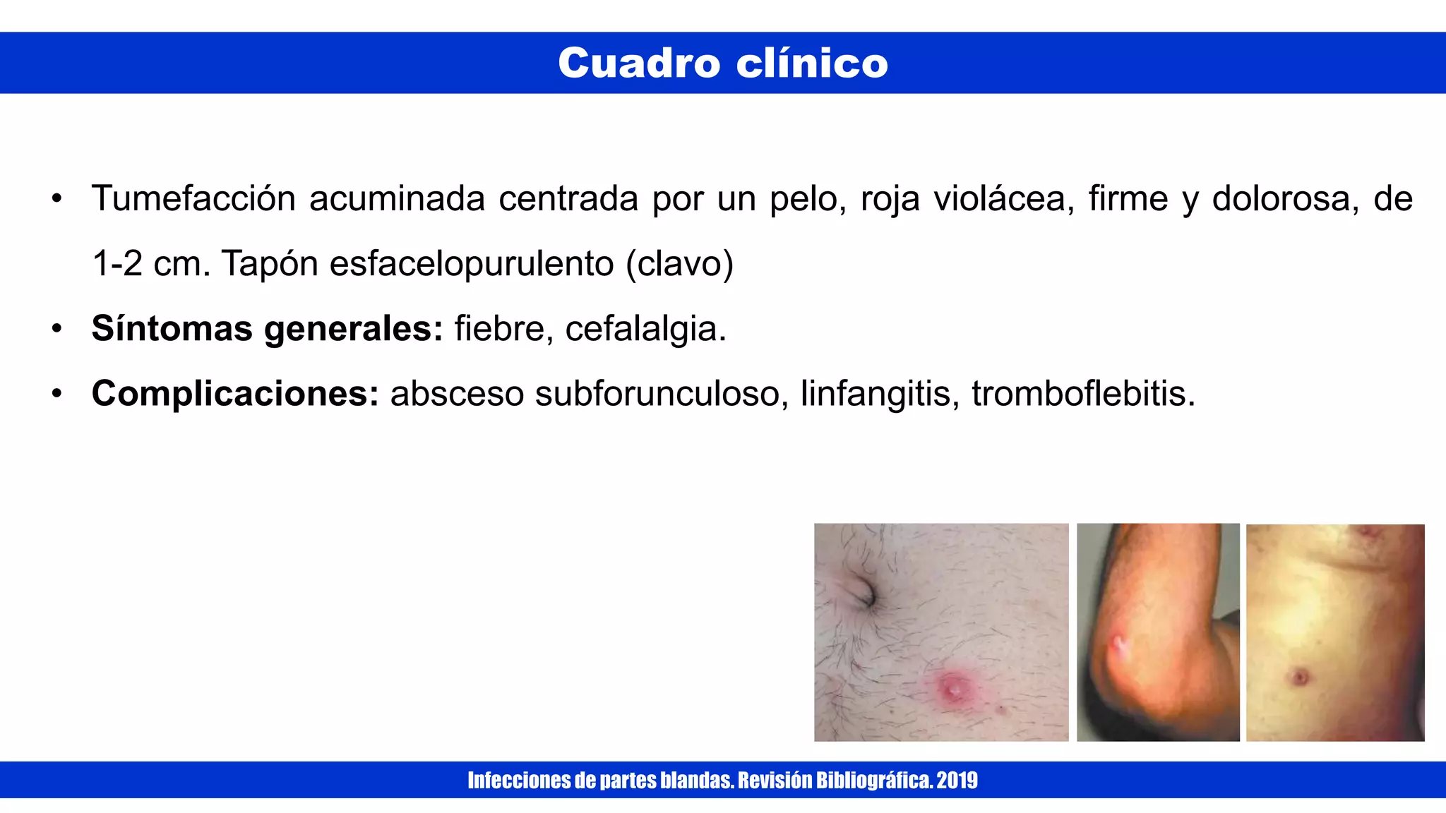 Infeccion de partes blandas final | PPTX