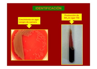 Infecciones por-Shewanella spp---------- | PDF