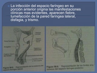 Infecciones5 | PPT