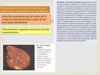 hepatopatias e Infecciones bacterianas | PPT