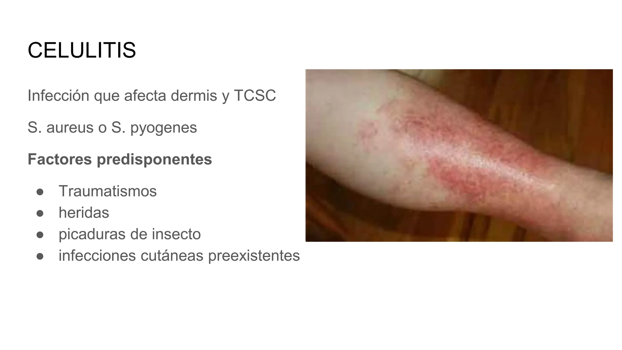 INFECCIONES BACTERIANAS EN PIEL Y SU CLINICA.pdf