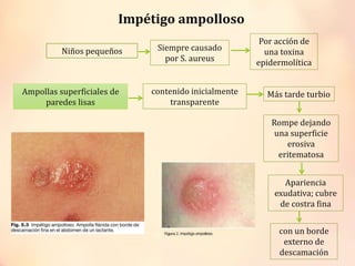 Infecciones cutáneas-Impétigo y ectima | PPT