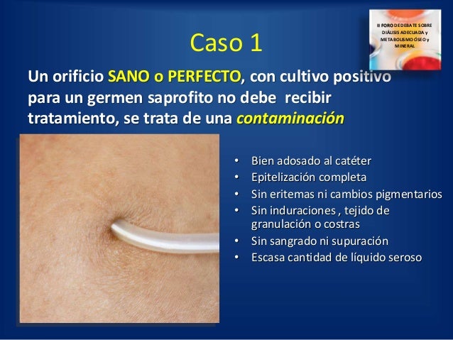INFECCIONES DEL CATETER DE DIALISIS PERITONEAL Y HEMODIALISIS