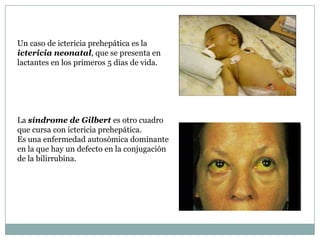 Infecciones de hígado e ictericia obstructiva | PPTX