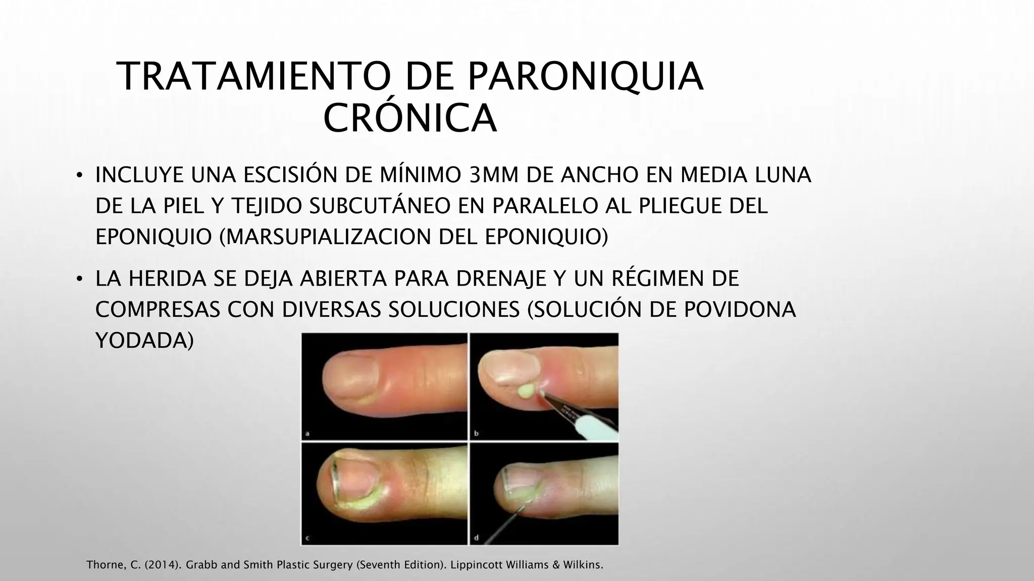 Infecciones de la punta de los dedos.pptx