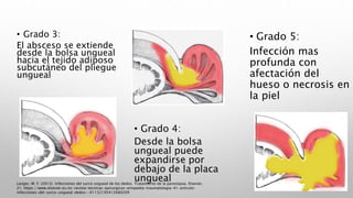 Infecciones de la punta de los dedos.pptx