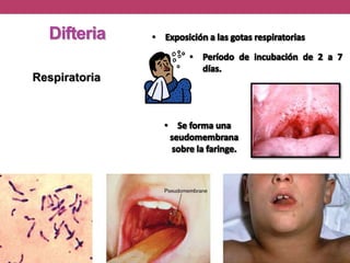 Infecciones de las vias respiratorias superiores | PPTX