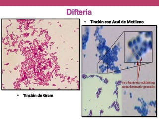 Infecciones de las vias respiratorias superiores | PPTX
