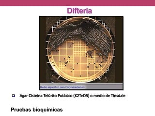 Infecciones de las vias respiratorias superiores | PPTX