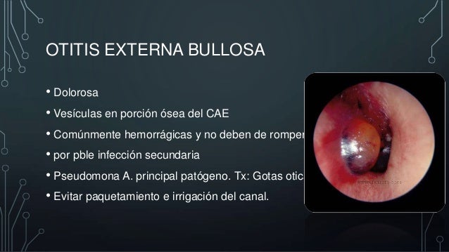 Infecciones del oído externo