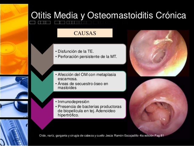 Infecciones del oido medio