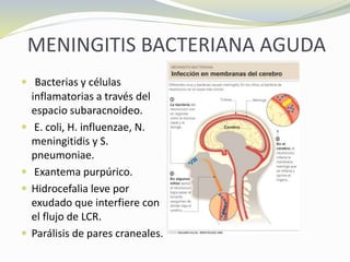 Diagrama De Células De Meningitis Bacteriana