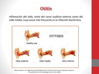 Infecciones de oido | PPTX
