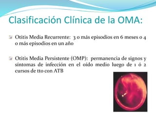 Infecciones de oido: Otitis media | PPTX