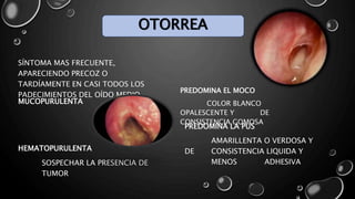 Infecciones de oido medio. Otorrinolaringologia. | PPTX