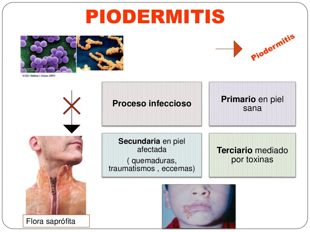 Infecciones de piel por bacterias y virus