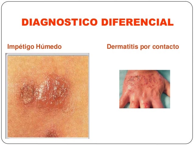 Bacterias En La Piel Pdf | LA PIEL: ESTRUCTURA Y FUNCIONES – JVTP