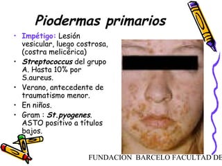 Infecciones de piel y partes blandas | PPT